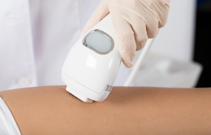 Les prestations Épilation définitive, BPDM